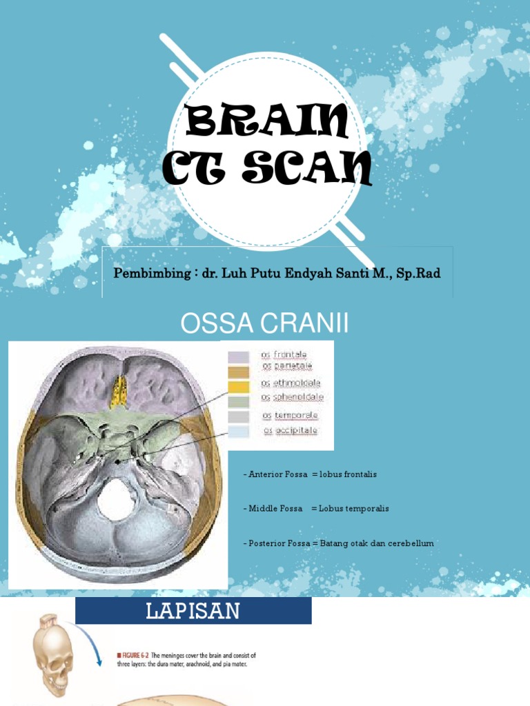 PR CT Scan Kepala | PDF
