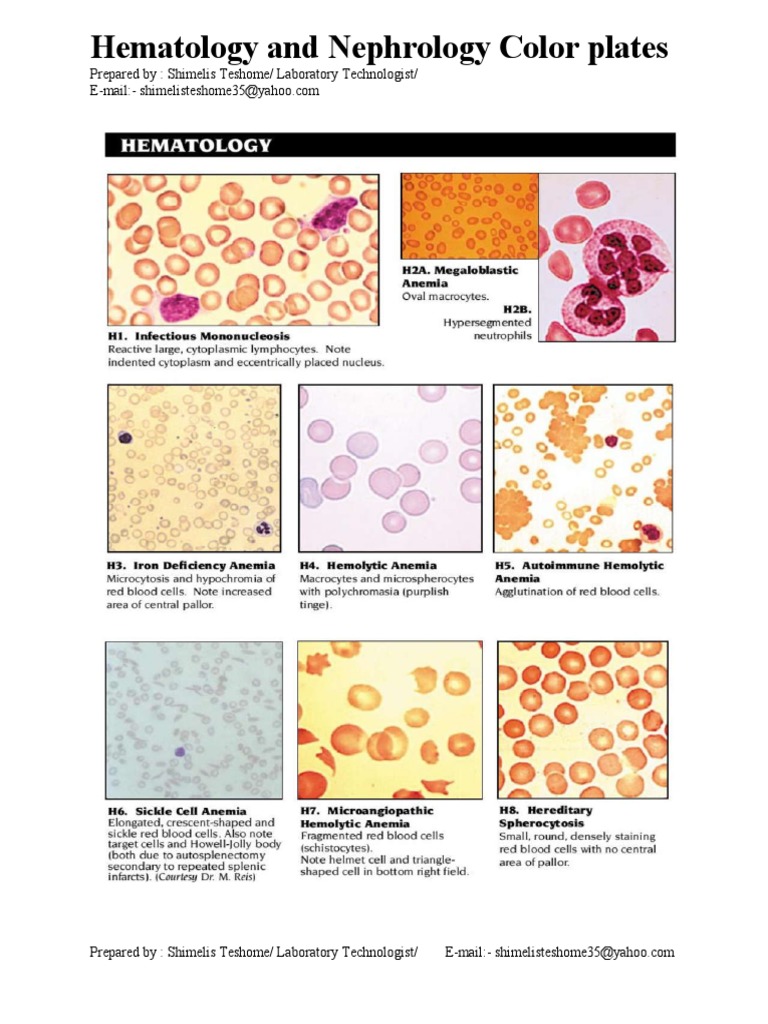 Hematology and Nephrology Color Plates | PDF
