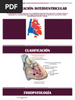 Distocia Funicular | PDF | Parto | Reproducción humana