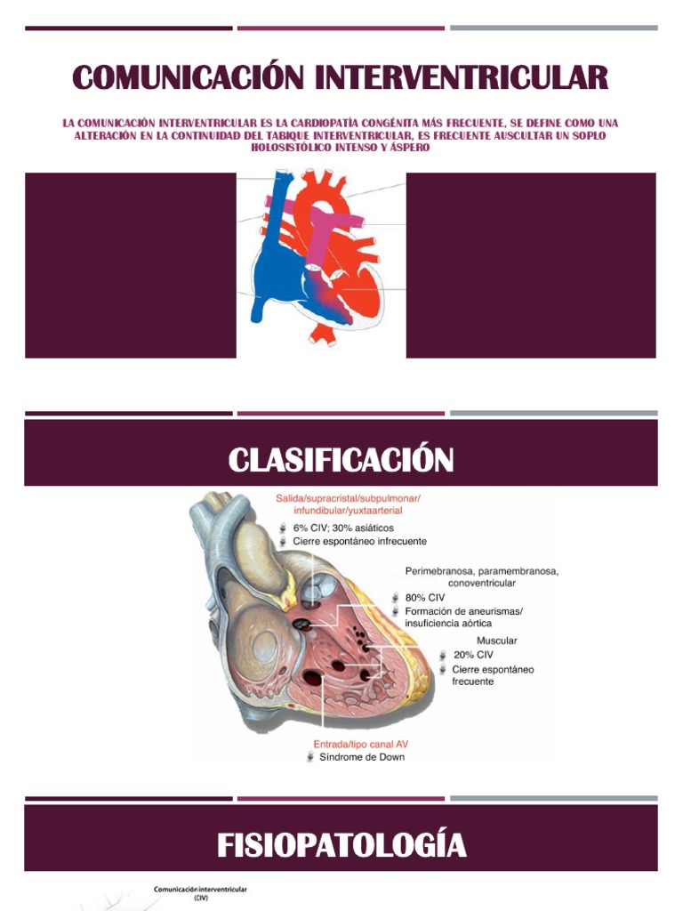 Comunicación Interventricular Pdf Sistema Cardiovascular