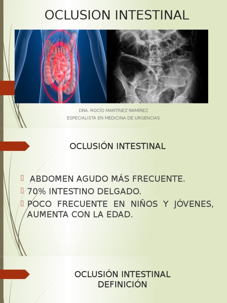 Oclusion Intestinal: Dra. Rocío Martínez Ramírez Especialista En ...