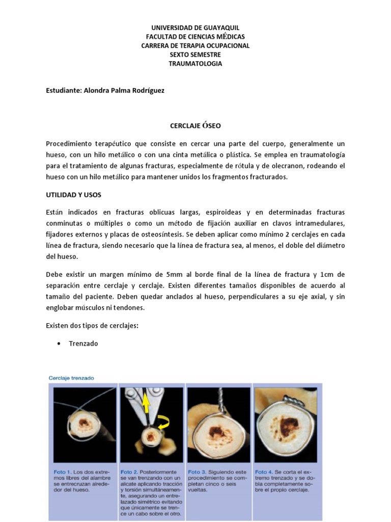 Cerclaje óseo en traumatología | PDF | Traumatologia | Sistema ...