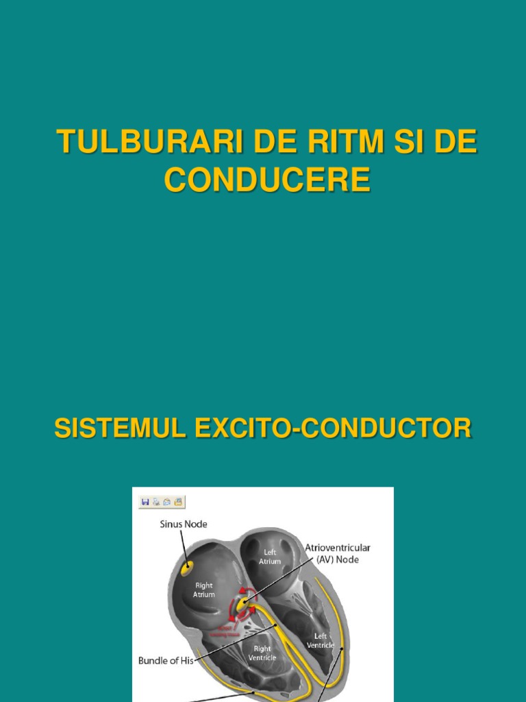 Tulburari de Ritm Si de Conducere | PDF