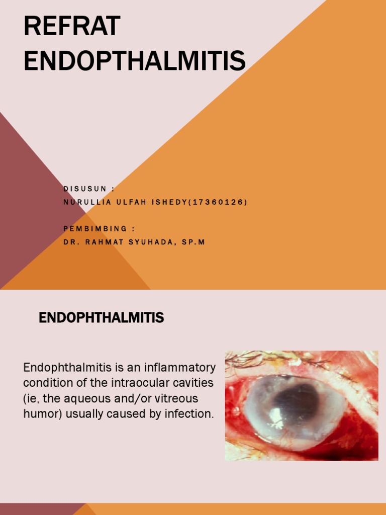 Endoftalmitis | PDF | Human Eye | Medicine