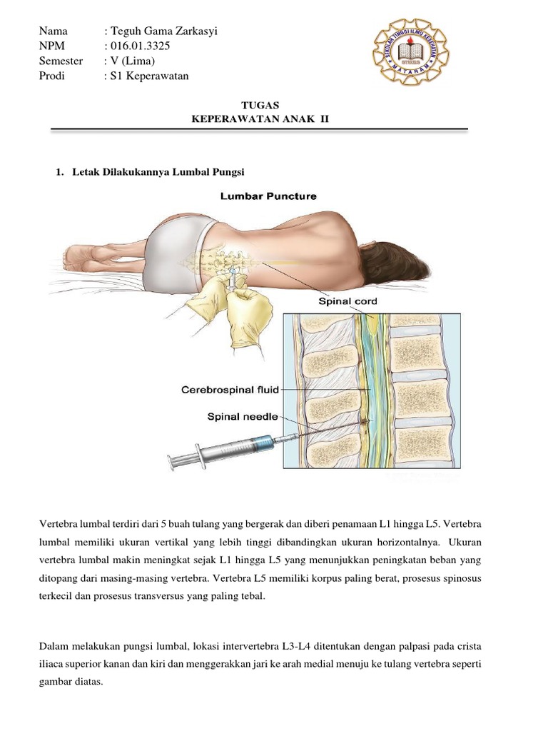 Lumbal Fungsi | PDF