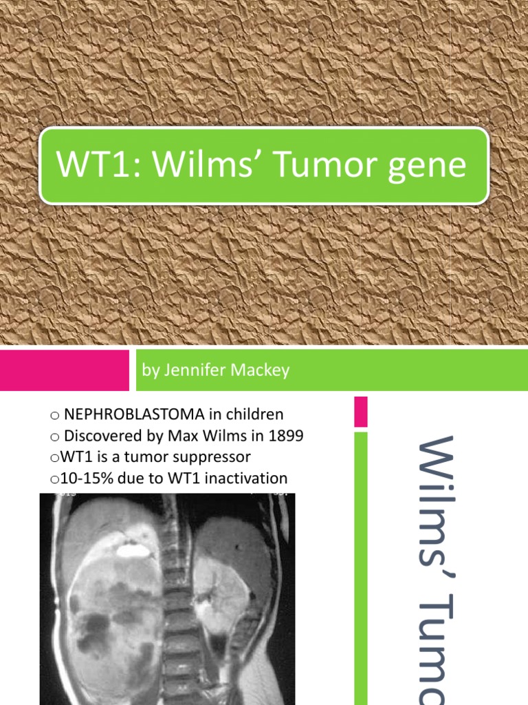 WT1: Wilms' Tumor Gene: by Jennifer Mackey | PDF | Cellular Processes ...