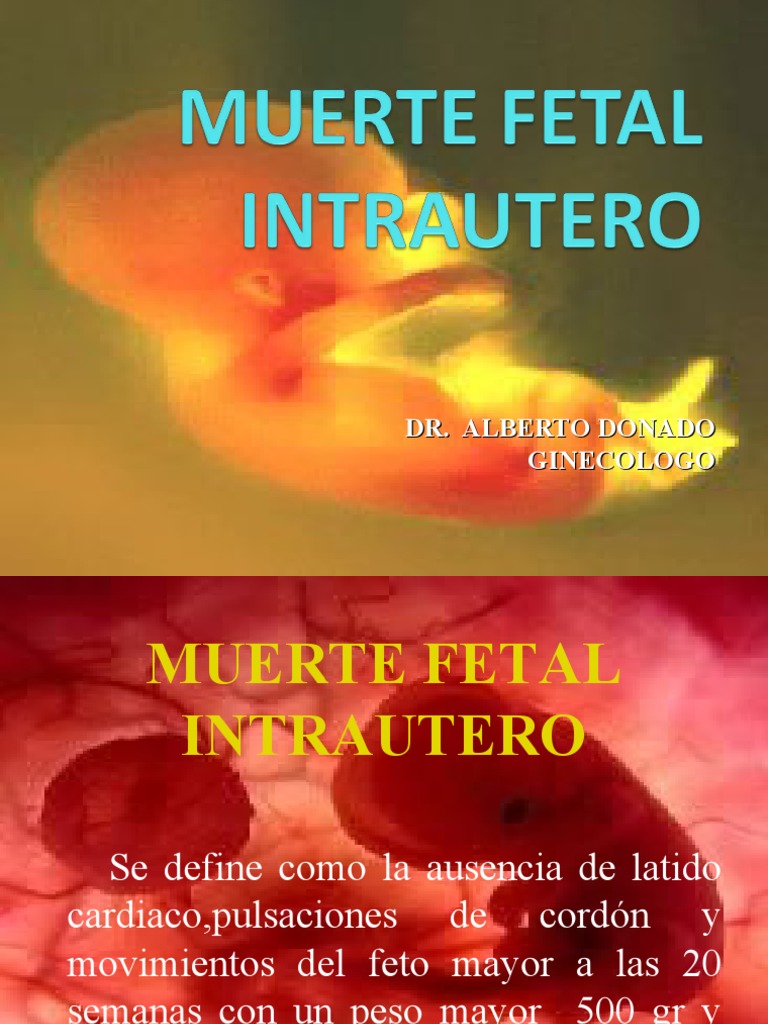 Muerte Fetal Intrautero | PDF | El embarazo | Feto