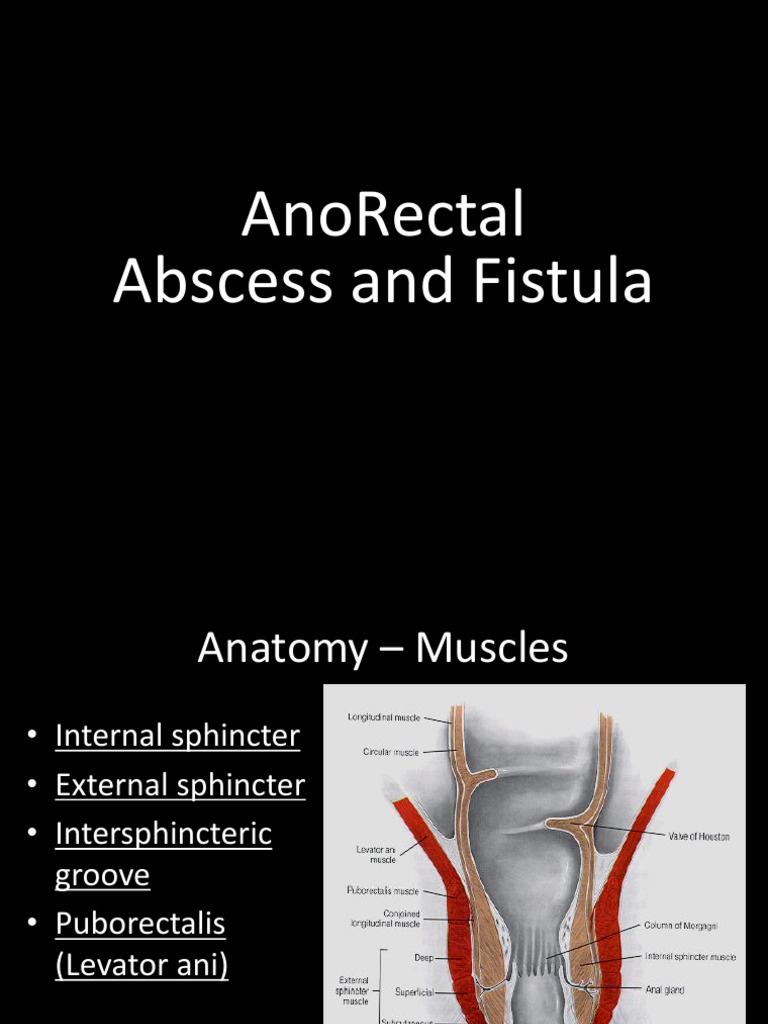 Anorectal Abscess and Fistula | PDF | Medical Specialties | Diseases ...
