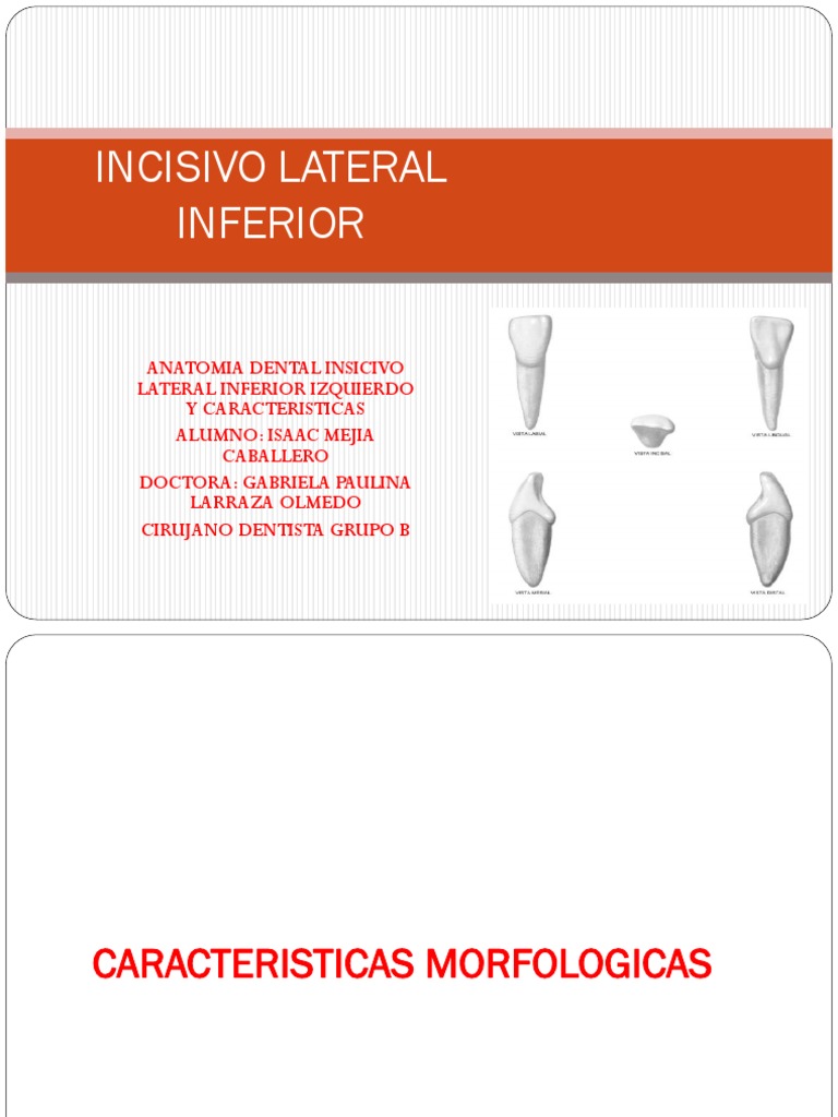 Incisivo Lateral Inferior Expo Issac | PDF