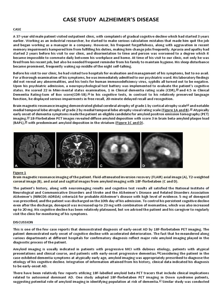 Alzheimer's Disease Case Study | PDF | Alzheimer's Disease | Dementia