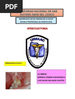 Operculectomía: Técnica y Procedimiento | PDF | Diente humano ...
