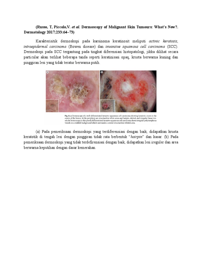 Dermoskopi | PDF