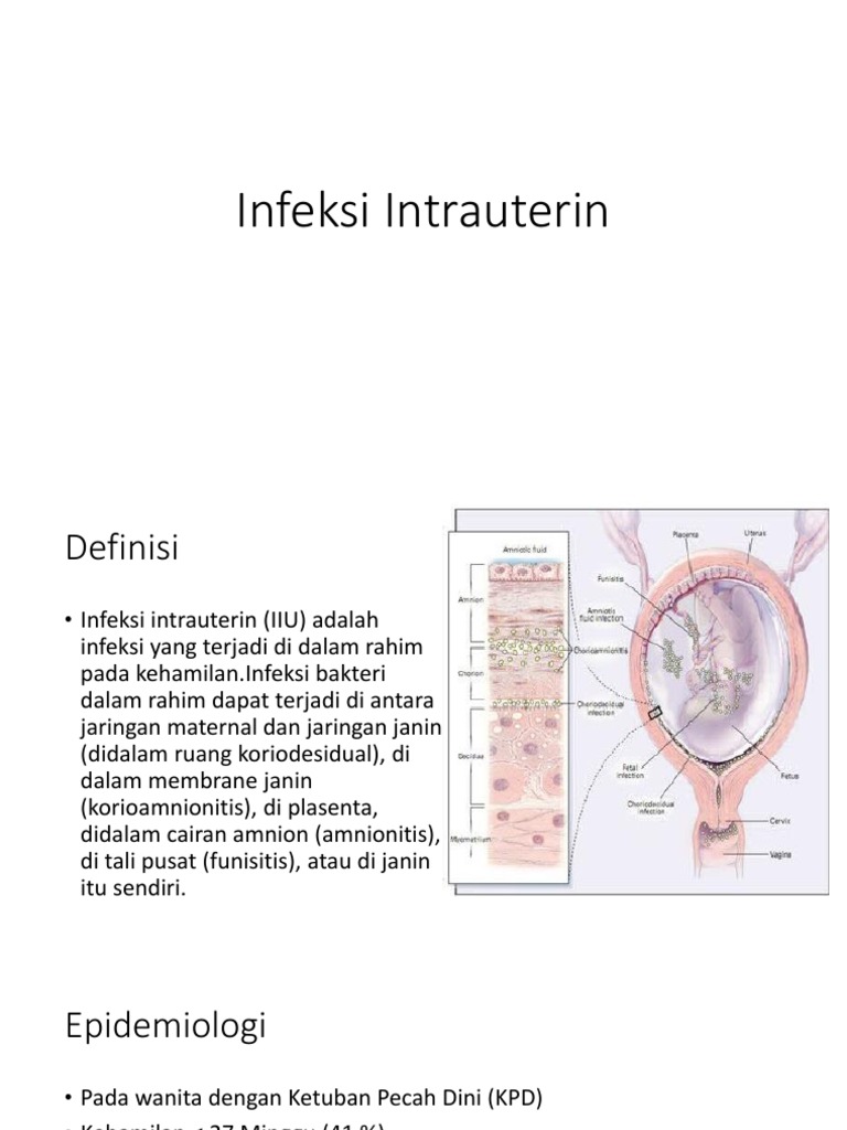 Infeksi Intrauterine | PDF