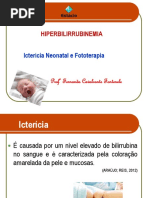 Nomograma de Buthani e indicações de fototerapia neonatal, como ...