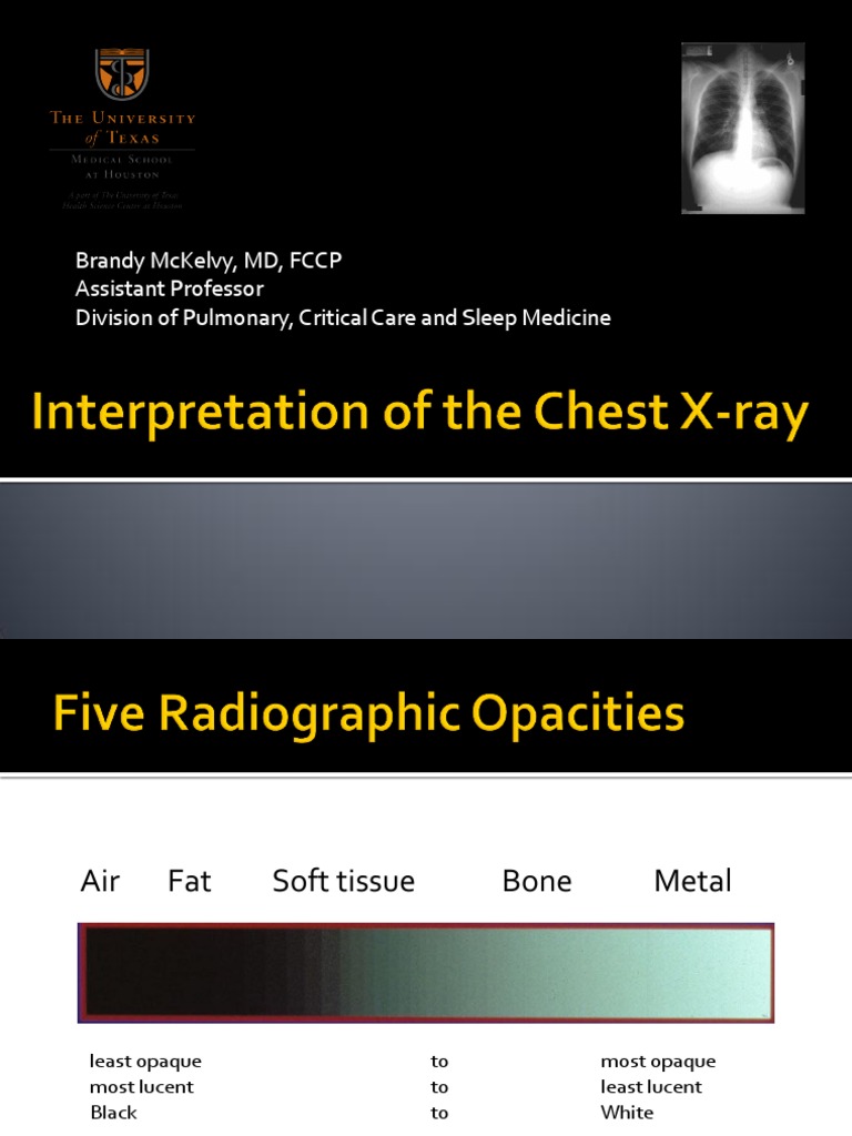 Interpretation Chest X Ray | PDF | Aorta | Lung