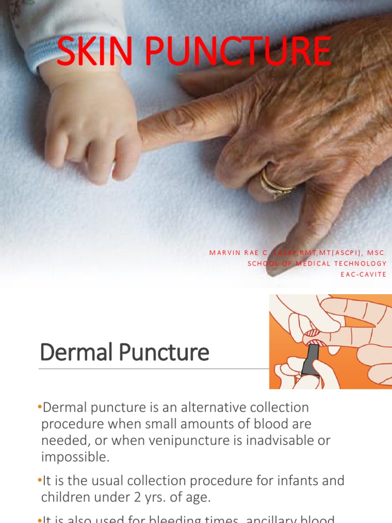 01 Skin Puncture | PDF | Blood | Vein