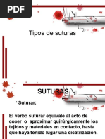 Pasos Quirúrgicos para La Cesárea Tipo Kerr | PDF | Abdomen | Seccion ...