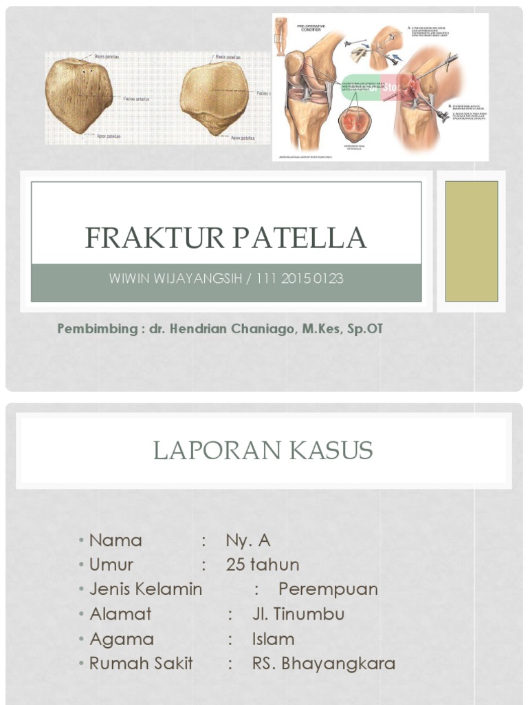 Fraktur Patella | PDF