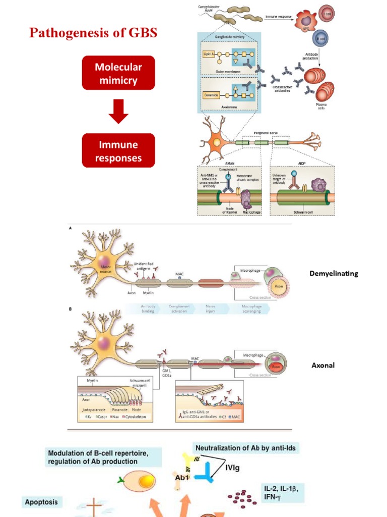 Pathogenesis of GBS: Molecular Mimicry | PDF