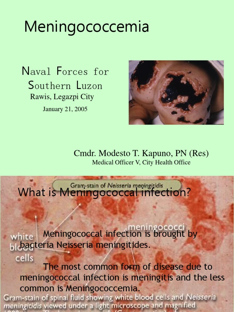 Meningococcemia: N F S L | PDF | Meningitis | Microbiology