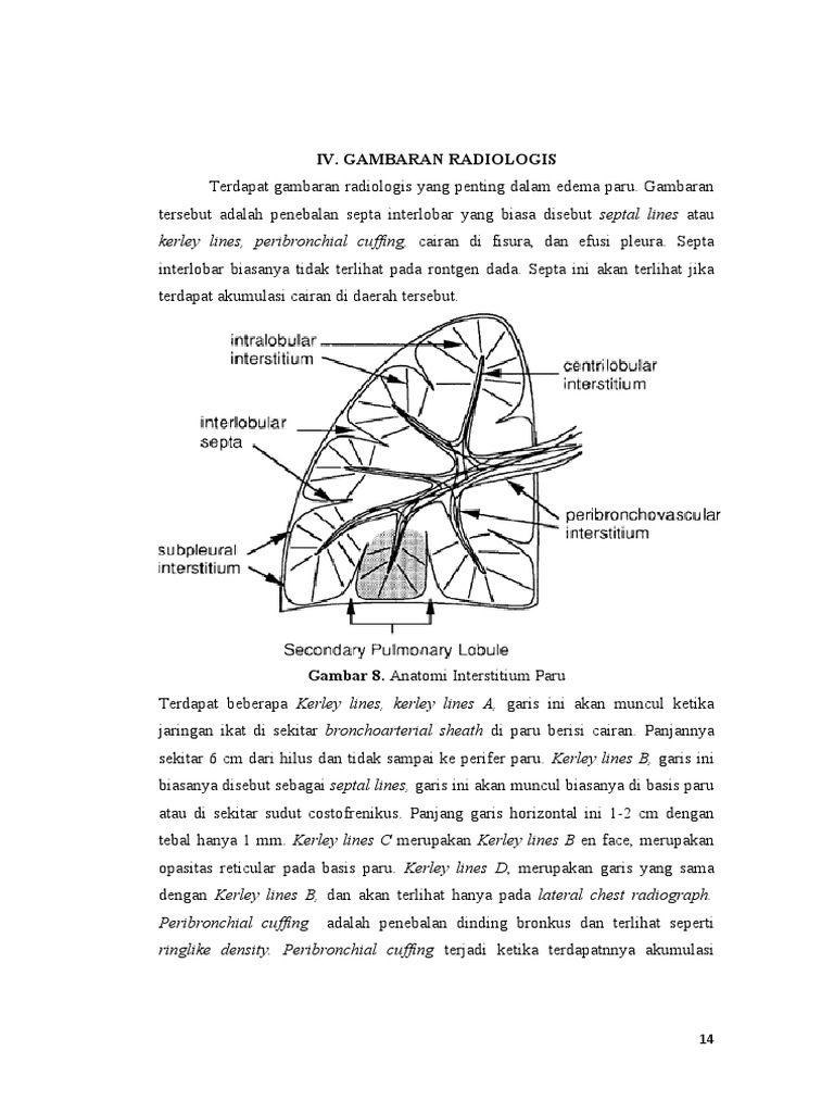 Gambaran Radiologis Edema Paru | PDF | Perjalanan | Seni