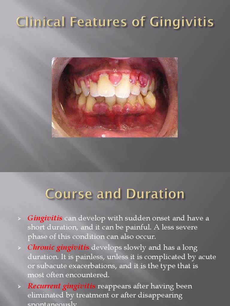 Clinical Features of Periodontitis | PDF | Dentistry | Mouth