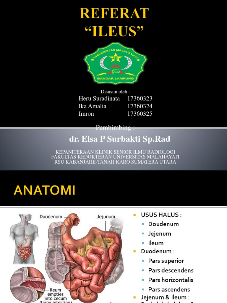 Refrat Ileus | PDF | Kesehatan Holistik | Sains & Matematika