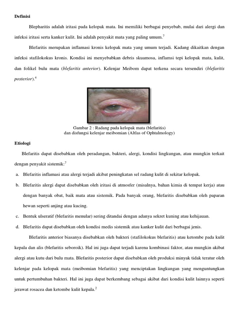 BLEPHARITIS | PDF | Kesehatan Holistik