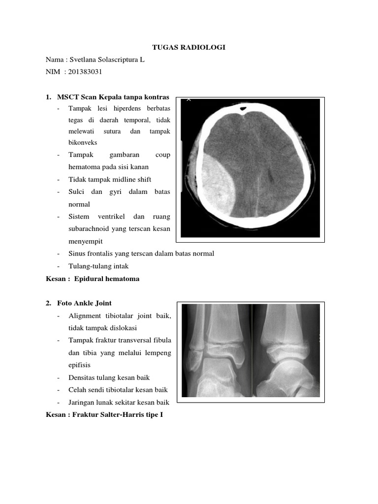 Tugas Radiologi | PDF | Sains & Matematika