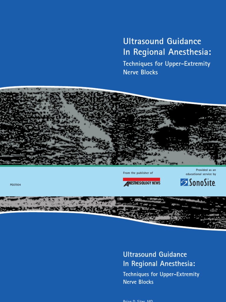 Ultrasound Guidance in Regional Anesthesia:: Techniques For Upper ...