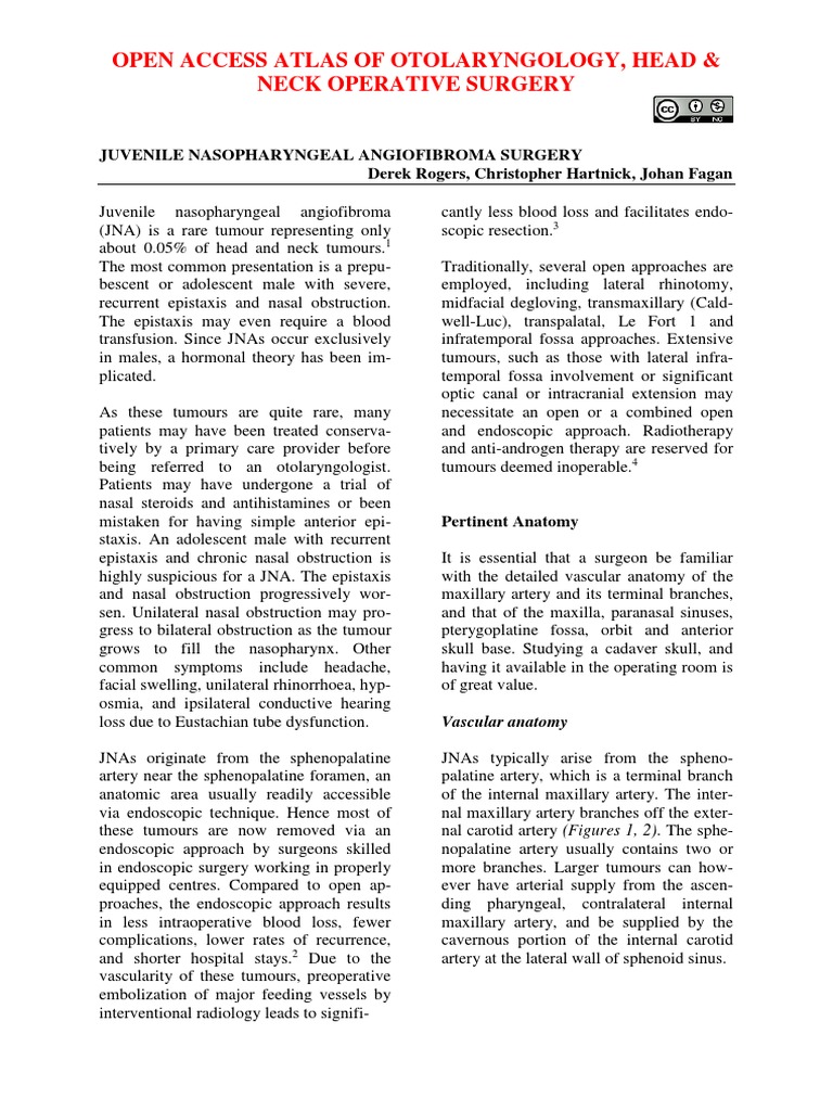 Juvenile Nasopharyngeal Angiofibroma Surgery | PDF | Human Nose ...
