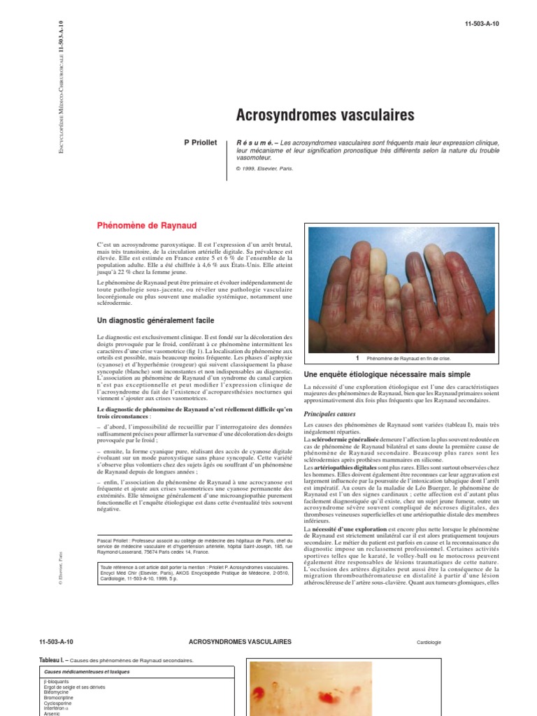 Acrosyndromes vasculaires | Douleur | Spécialités médicales