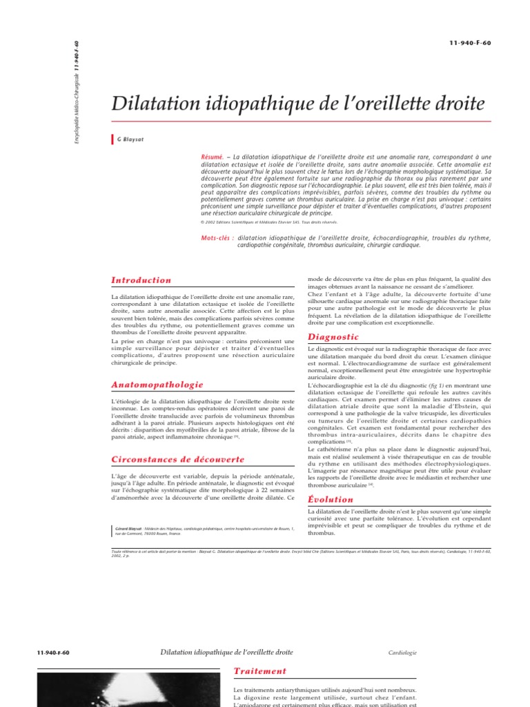 Dilatation Idiopathique de L'oreillette Droite | PDF | Atrium (anatomie ...