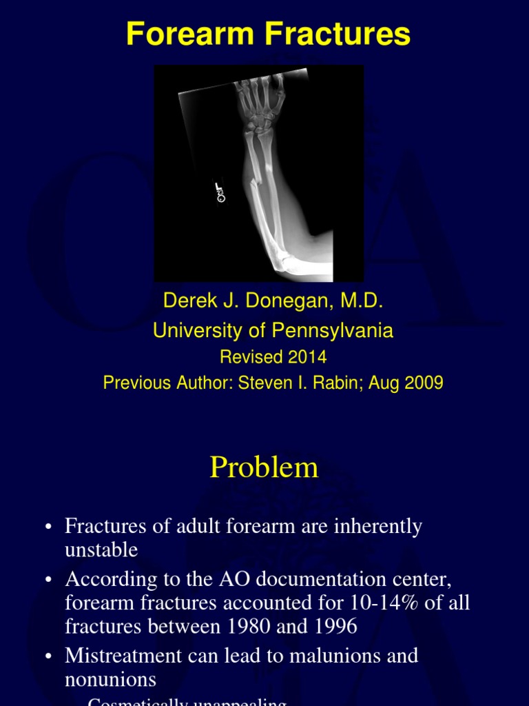 Forearm Fractures: Derek J. Donegan, M.D. University of Pennsylvania ...