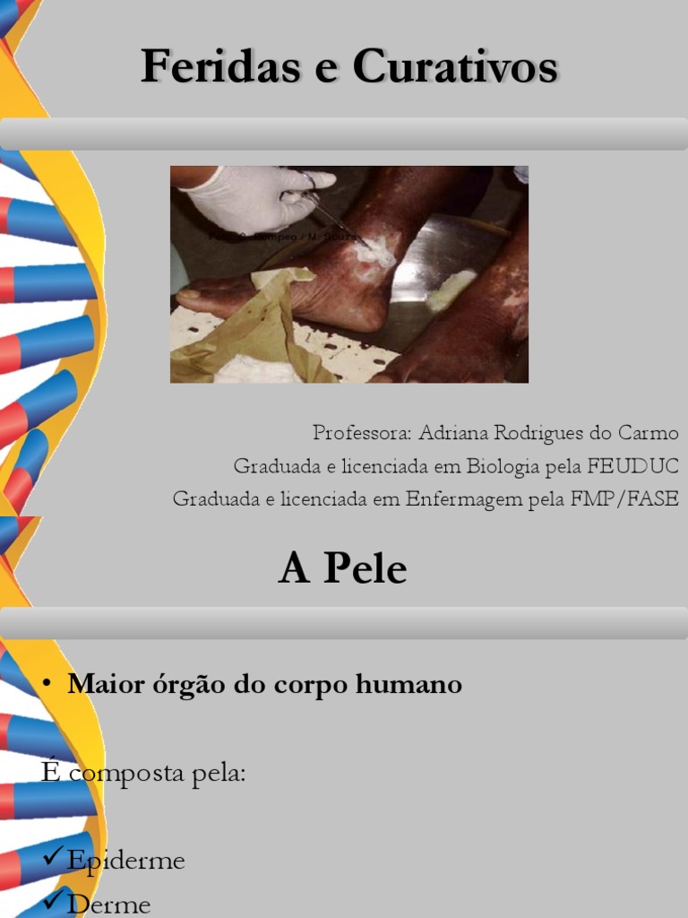 03-FERIDAS & CURATIVOS-1-1.pdf | Pele | Epiderme