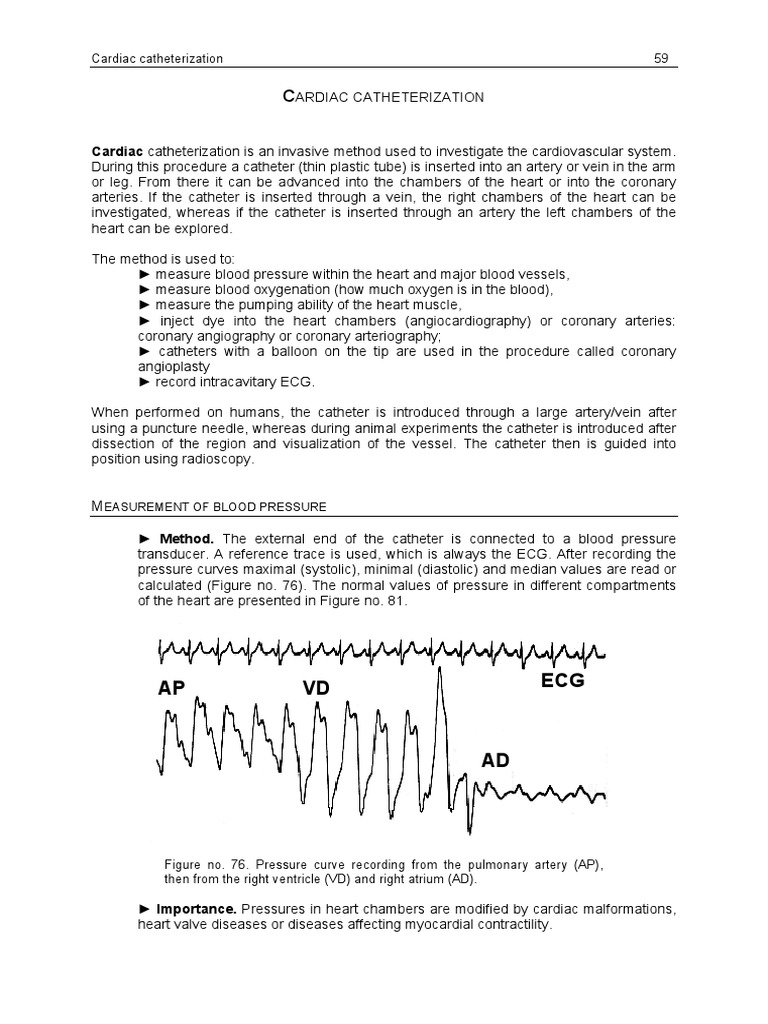 Cardiac Catheterization | PDF | Ventricle (Heart) | Heart