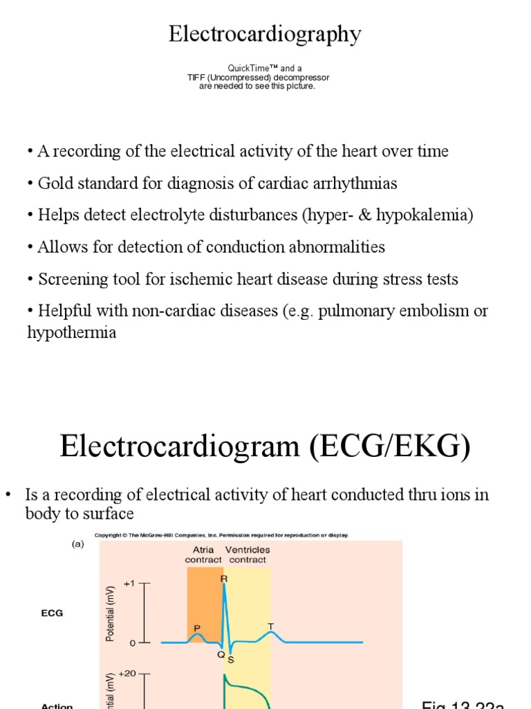 ECG.ppt | Electrocardiography | Heart
