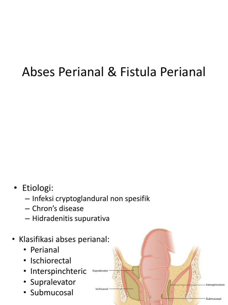 Abses Perianal - Fistula Perianal | PDF