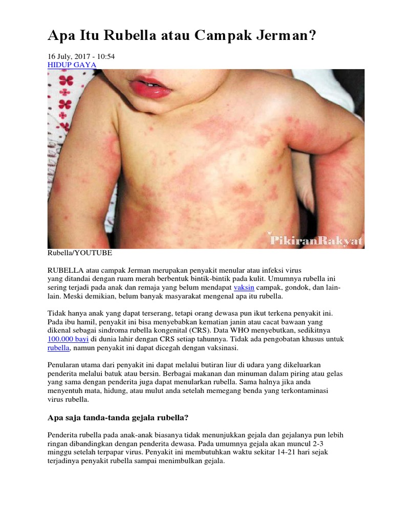 Apa Itu Rubella Atau Campak Jerman | PDF