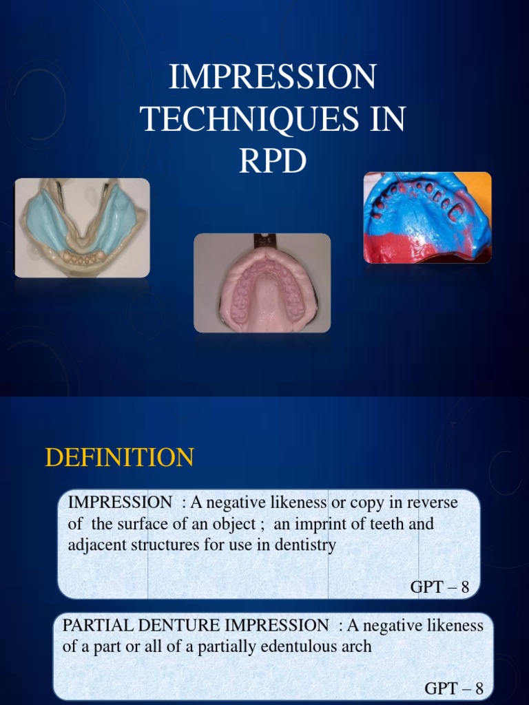 Impression Procedures in RPD | PDF | Dentures | Mouth