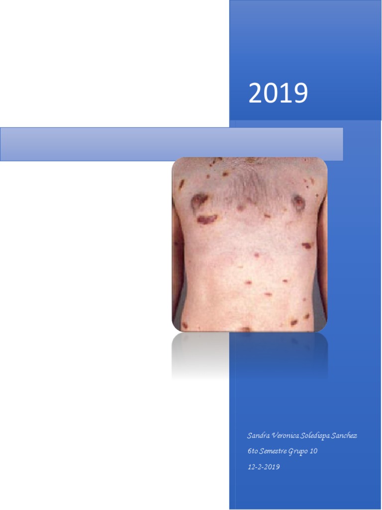 Sarcoma de Kaposi | PDF | Cáncer | VIH / SIDA