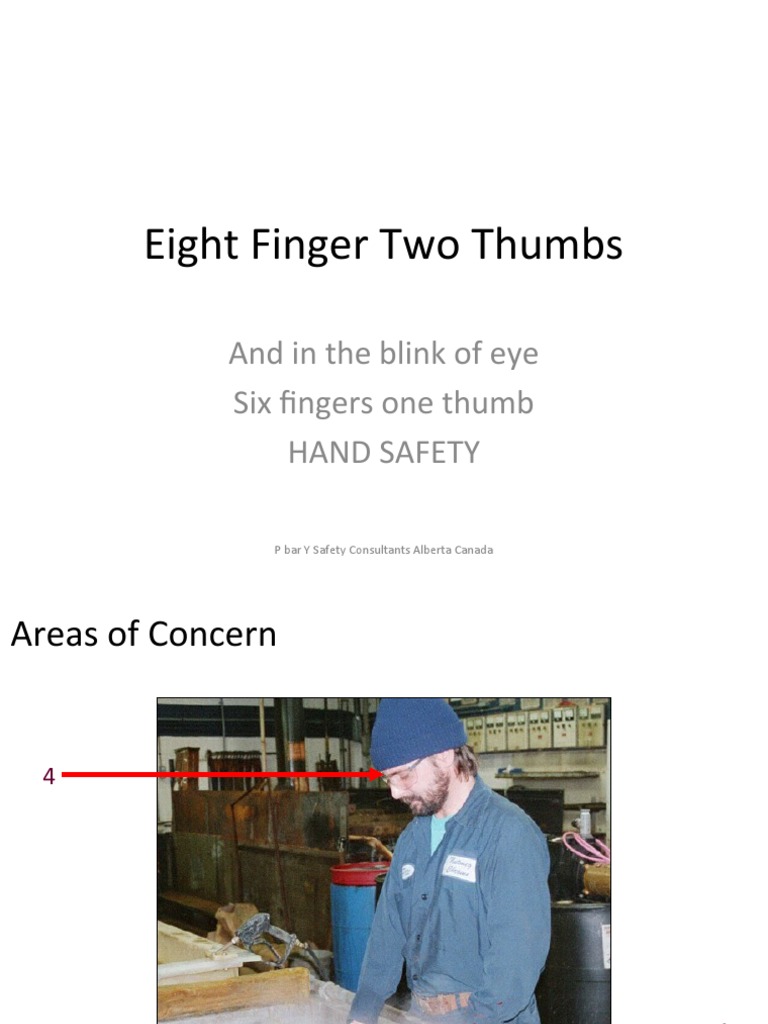 Essential Hand Safety Guidelines | PDF | Glove | Personal Protective ...