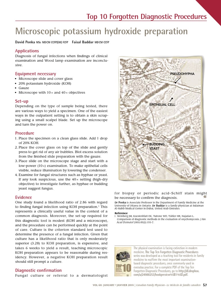 Microscopic Potassium Hydroxide Preparation: Top 10 Forgotten ...