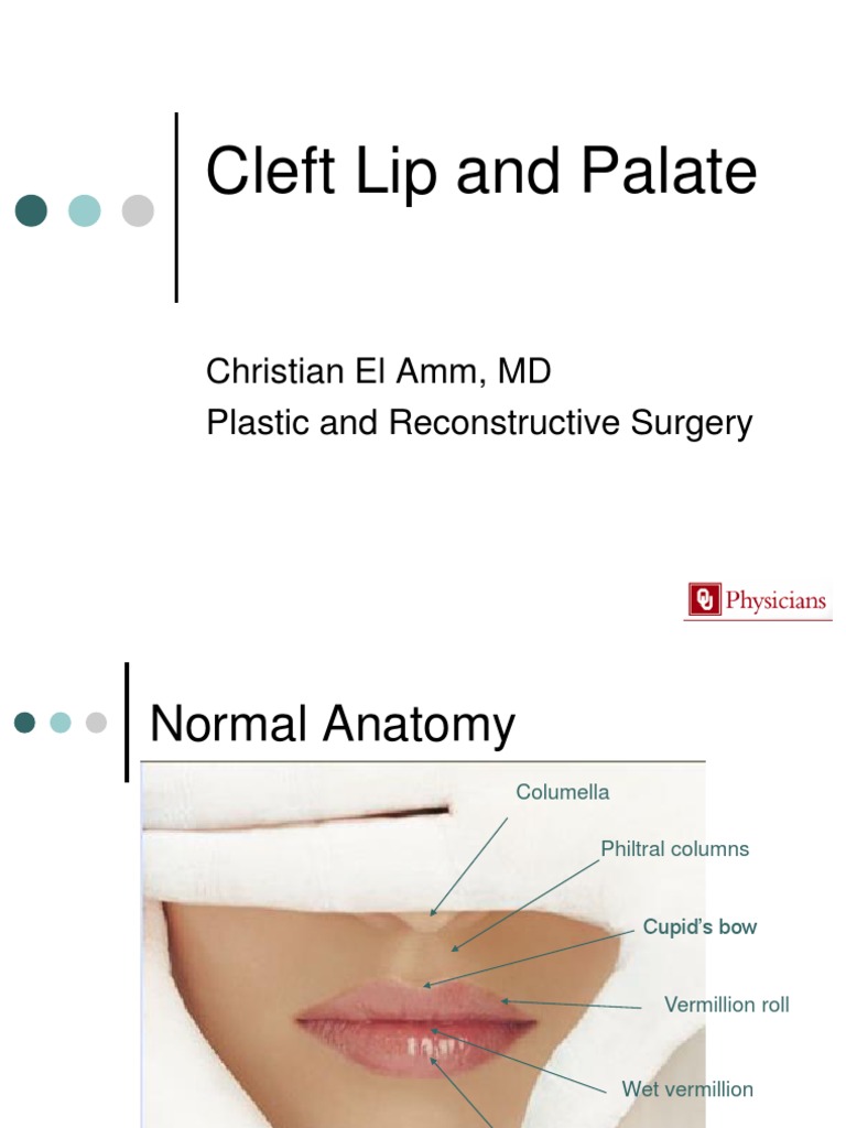 Cleft Lip and Palate | Download Free PDF | Human Anatomy | Mouth