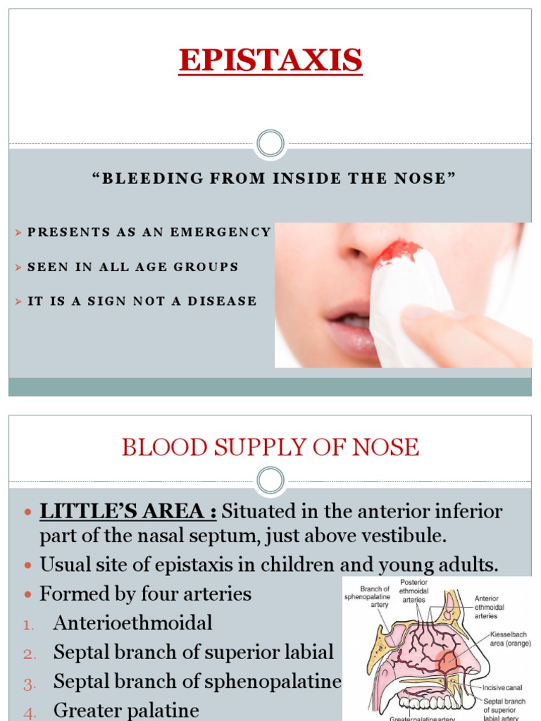 Epistaxis: "Bleeding From Inside The Nose" | PDF | Human Nose | Vein