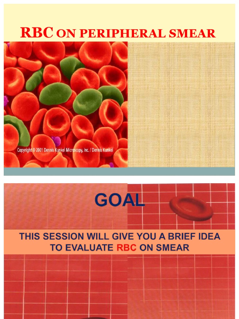 RBC Morphology and Abnormalities Guide | PDF | Anemia | Red Blood Cell