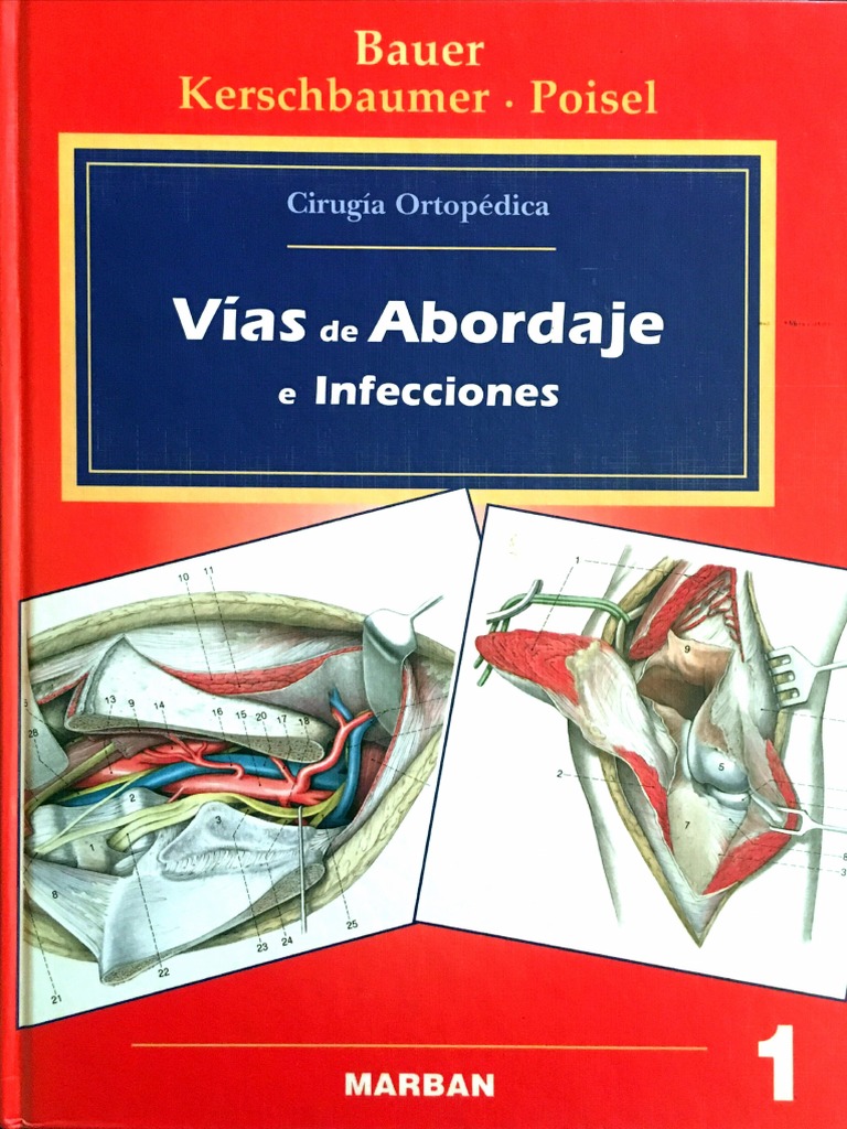 Abordaje Deltopectoral