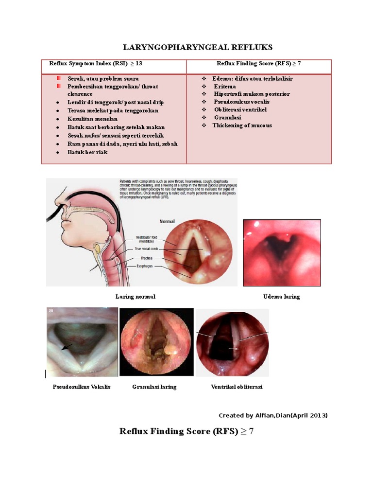 Reflux Symptom Index | PDF | Larynx | Human Head And Neck