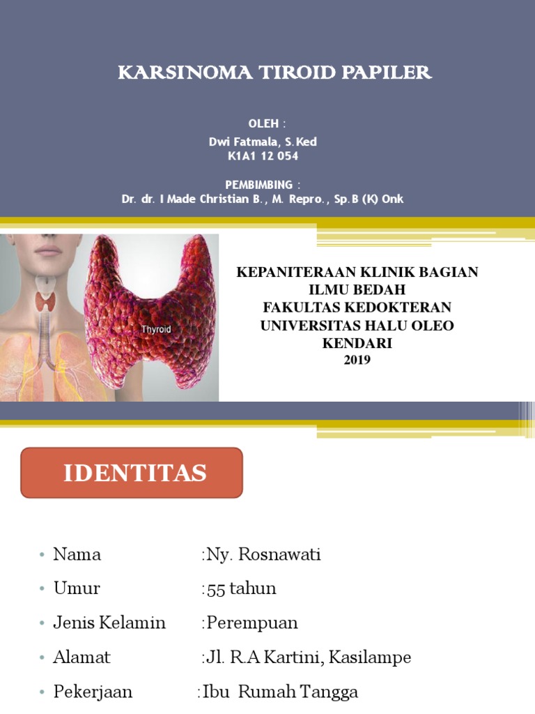 Karsinoma Tiroid Papiler: Kasus Ny. Rosnawati | PDF