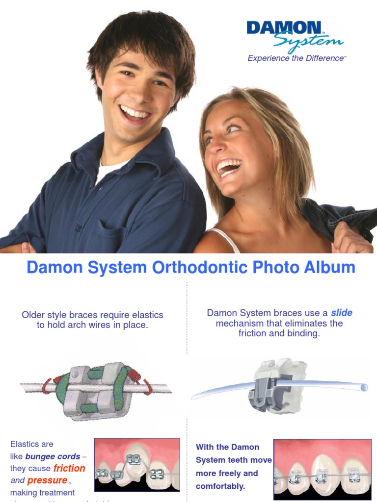 Damon System Orthodontic Photo Album: Experience The Difference | PDF ...
